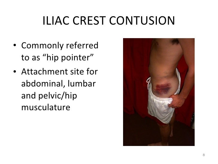 Kin191 A.Ch.8. Pelvis. Thigh. Injuries