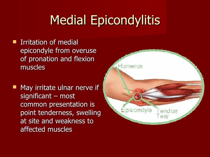 Kin 191 B – Elbow And Forearm Pathologies