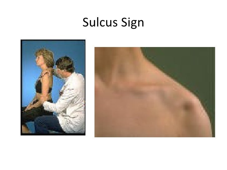 Kin 191 B – Shoulder Injuries