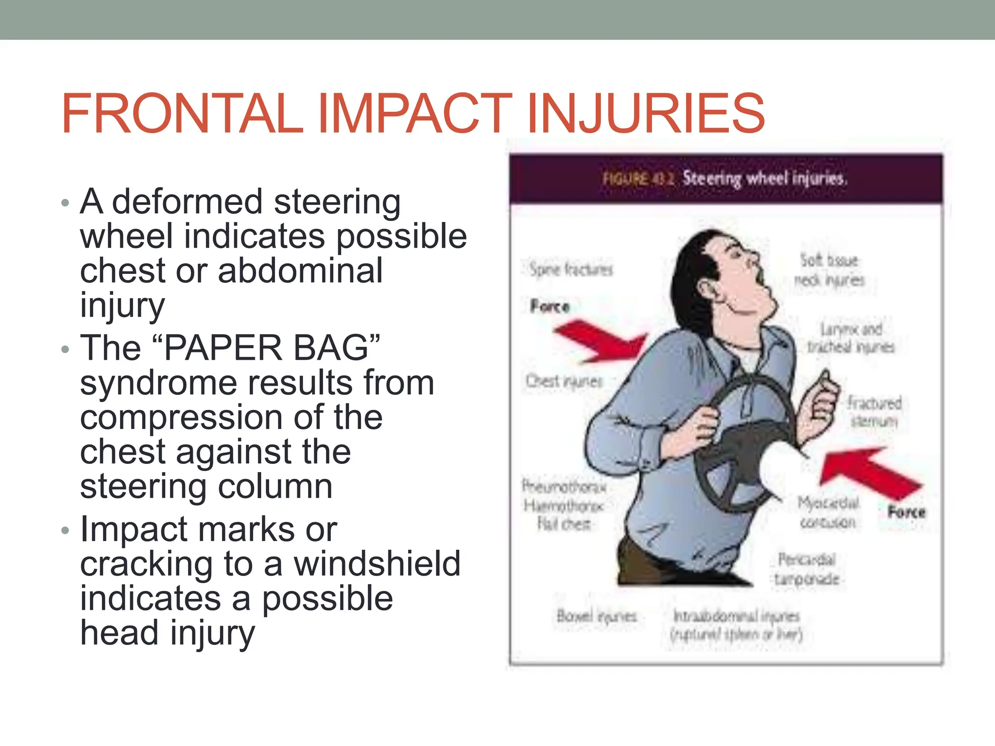 KINEMATICS OF TRAUMA IN ROAD TRAFFIC ACCIDENTS | PPTX