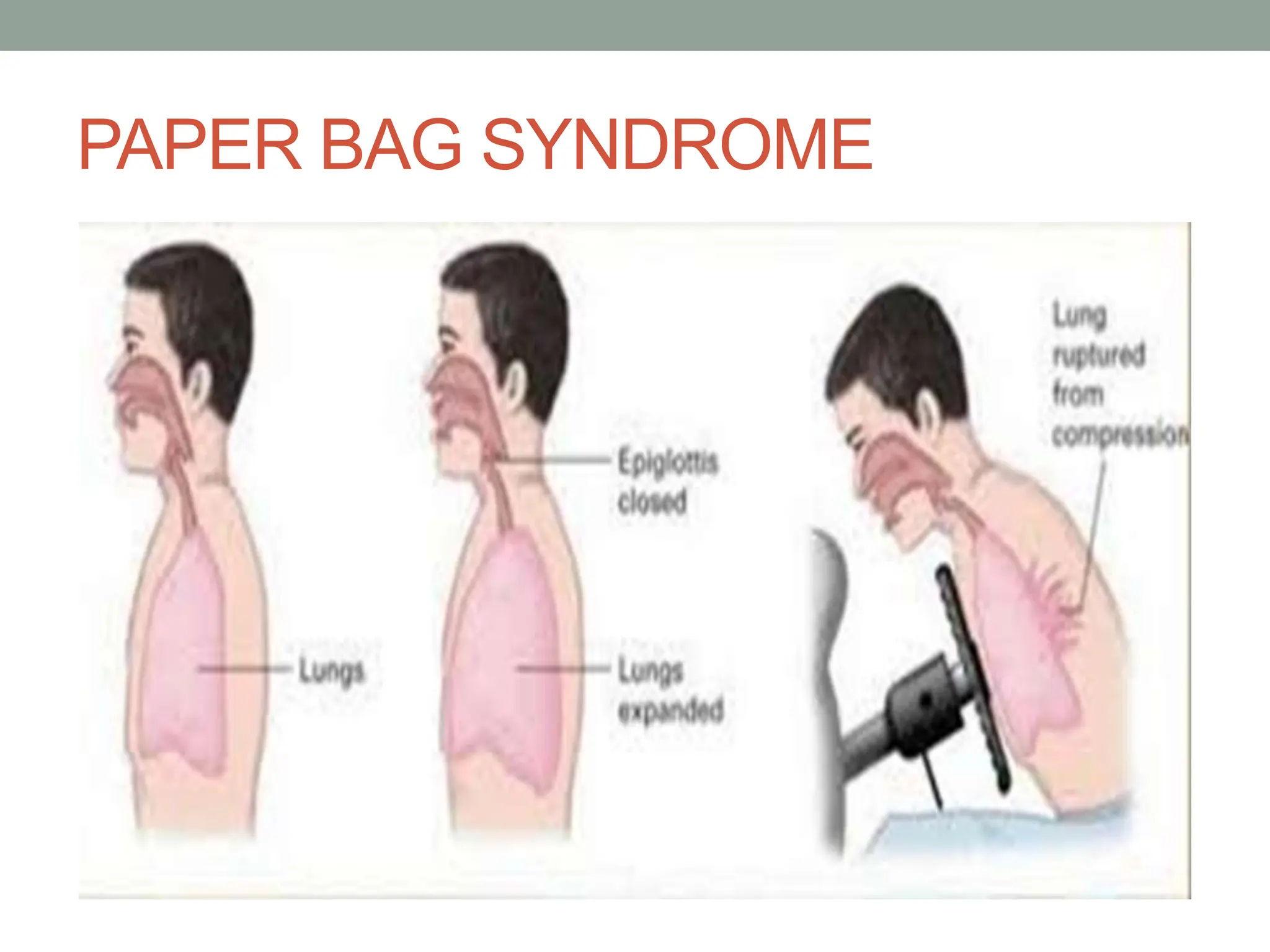 KINEMATICS OF TRAUMA IN ROAD TRAFFIC ACCIDENTS | PPTX