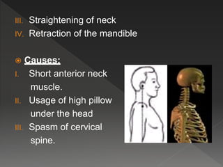 Kinesiology Postures and its types | PPTX