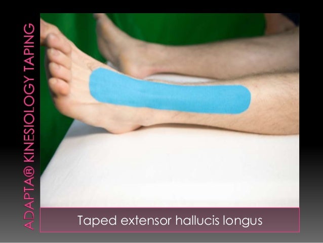 Kinesiology Taping Hallucis Longus