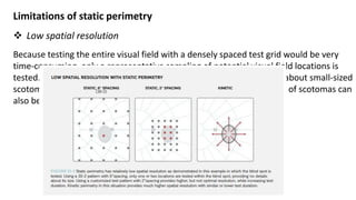 Kinetic perimetry.pptx