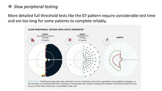 Kinetic perimetry.pptx