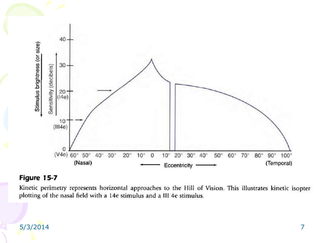 Kinetic vs static & automated | PPTX | Eye and Vision Conditions ...