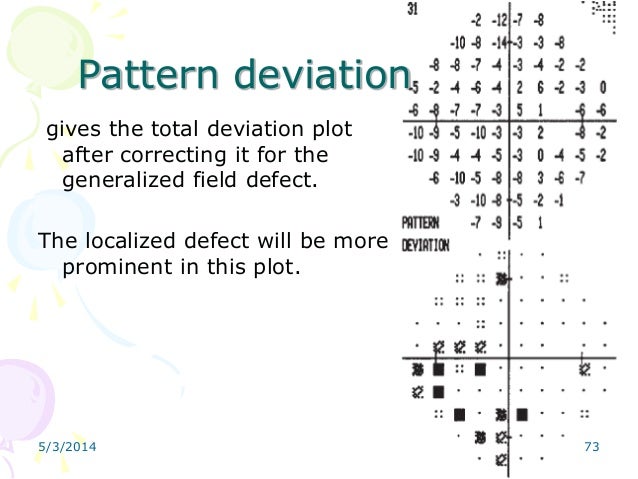 Kinetic vs static & automated