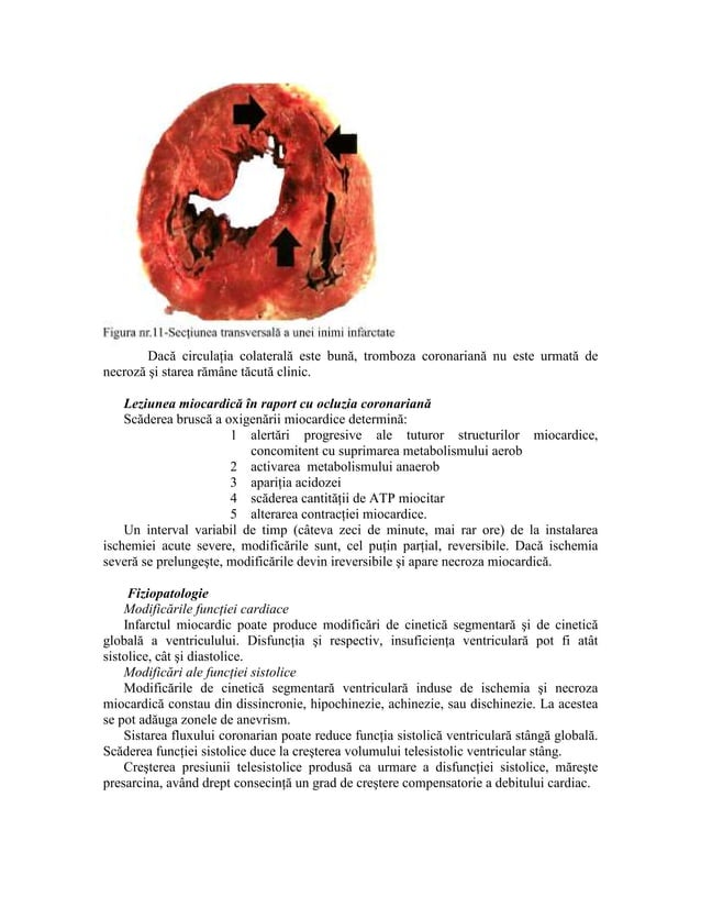 Kinetoterapie in afectiuni cardiovasculare | PDF