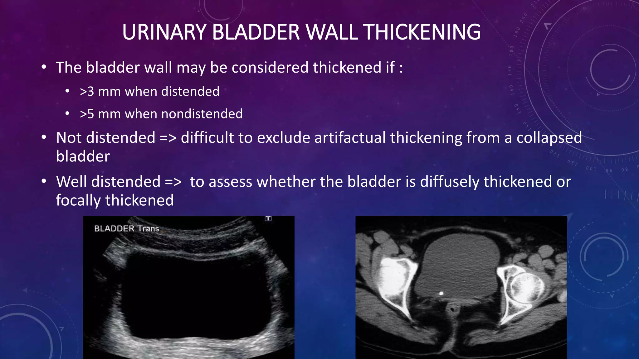 Urinary system – common pathological correlation | PPTX