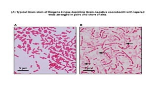 Kingella | PPTX | Chemistry | Science