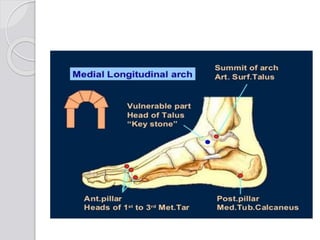 Kinisiology arch of foot | PPTX