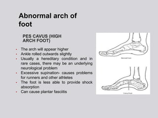 Kinisiology arch of foot | PPTX