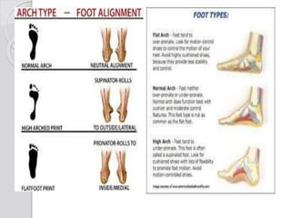 Kinisiology arch of foot | PPTX