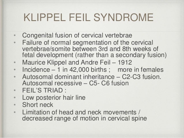 Acase of Klippel feil syndrome