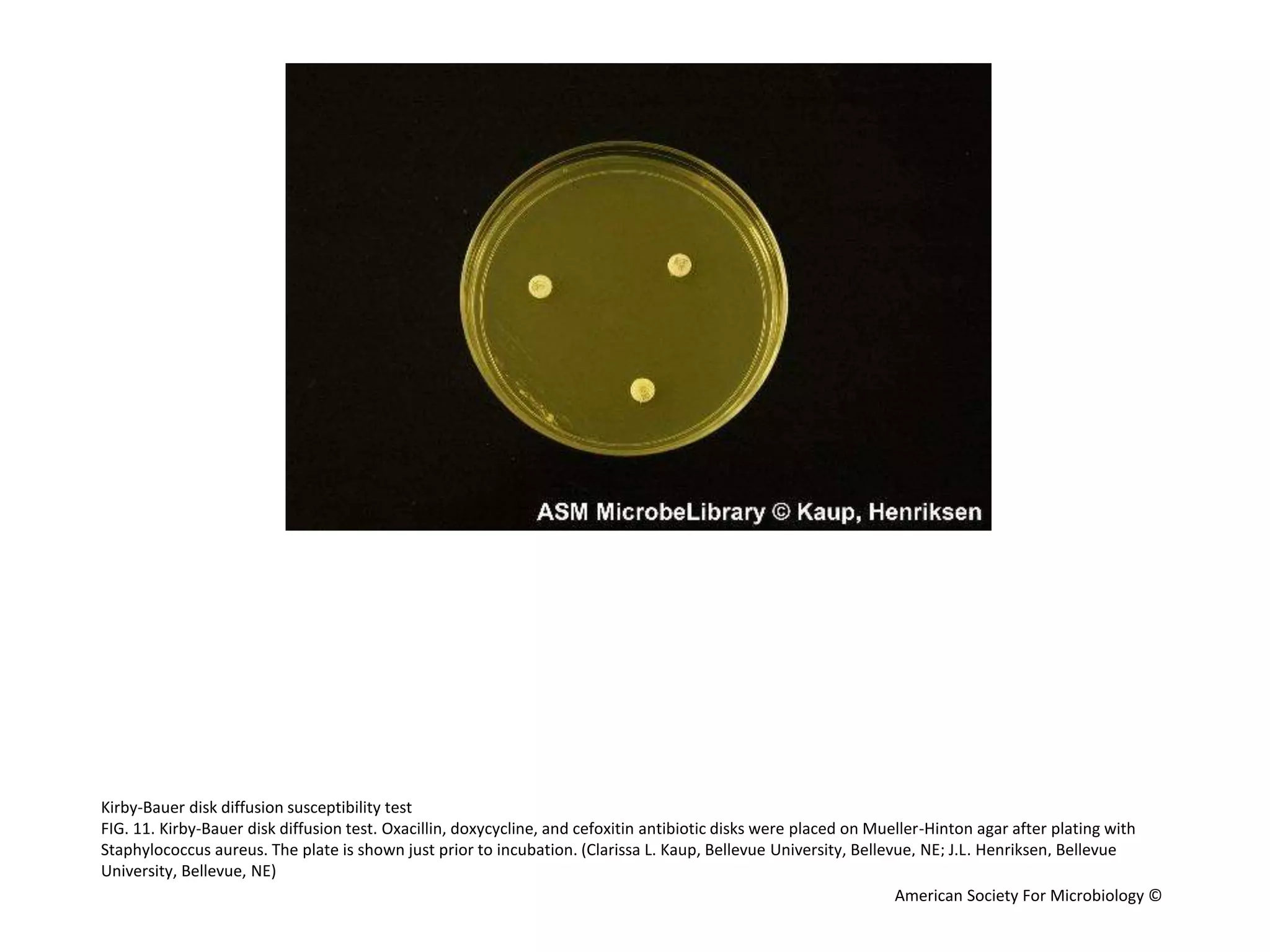 KIRBY-BAUER-DISK-DIFFUSION-SUSCEPTIBILITY-TEST.pptx