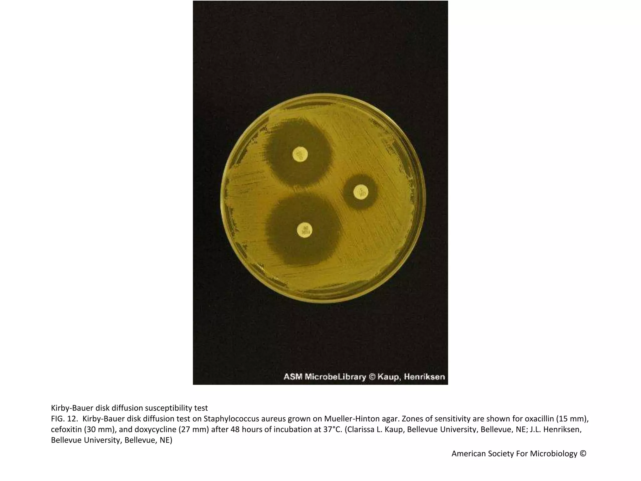 KIRBY-BAUER-DISK-DIFFUSION-SUSCEPTIBILITY-TEST.pptx