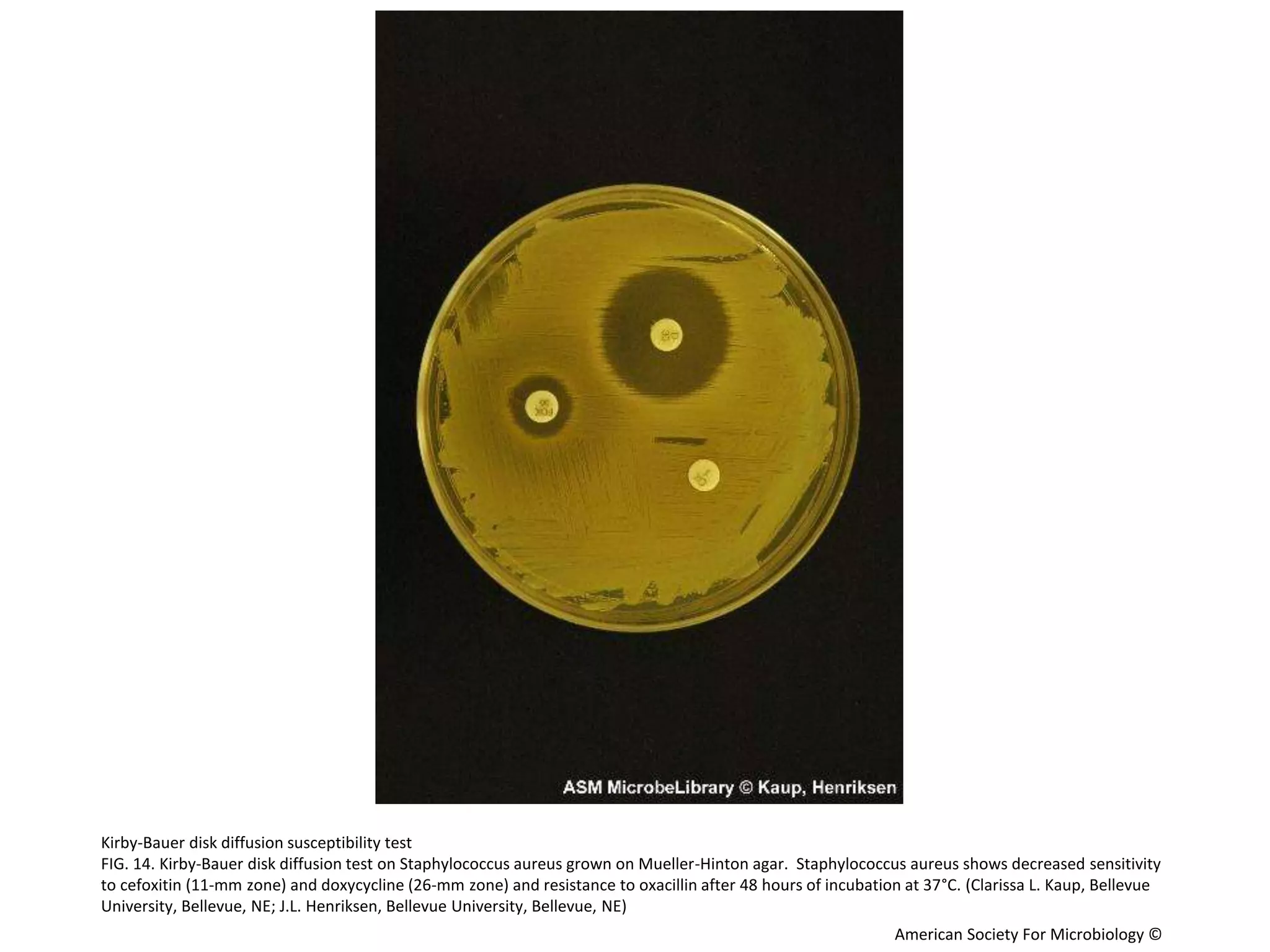 KIRBY-BAUER-DISK-DIFFUSION-SUSCEPTIBILITY-TEST.pptx