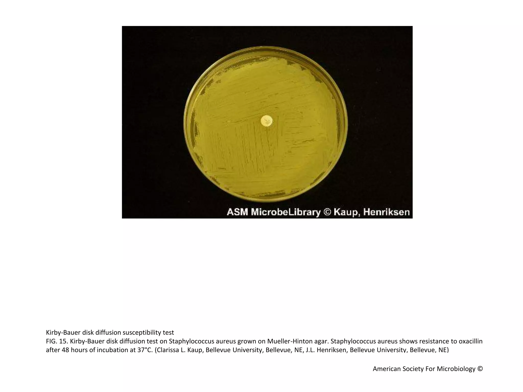 KIRBY-BAUER-DISK-DIFFUSION-SUSCEPTIBILITY-TEST.pptx