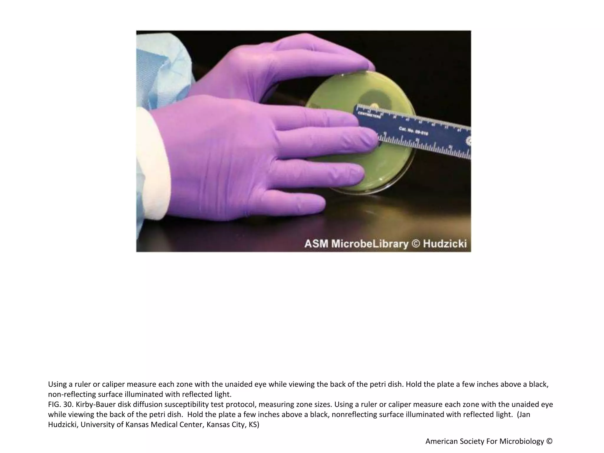 KIRBY-BAUER-DISK-DIFFUSION-SUSCEPTIBILITY-TEST.pptx