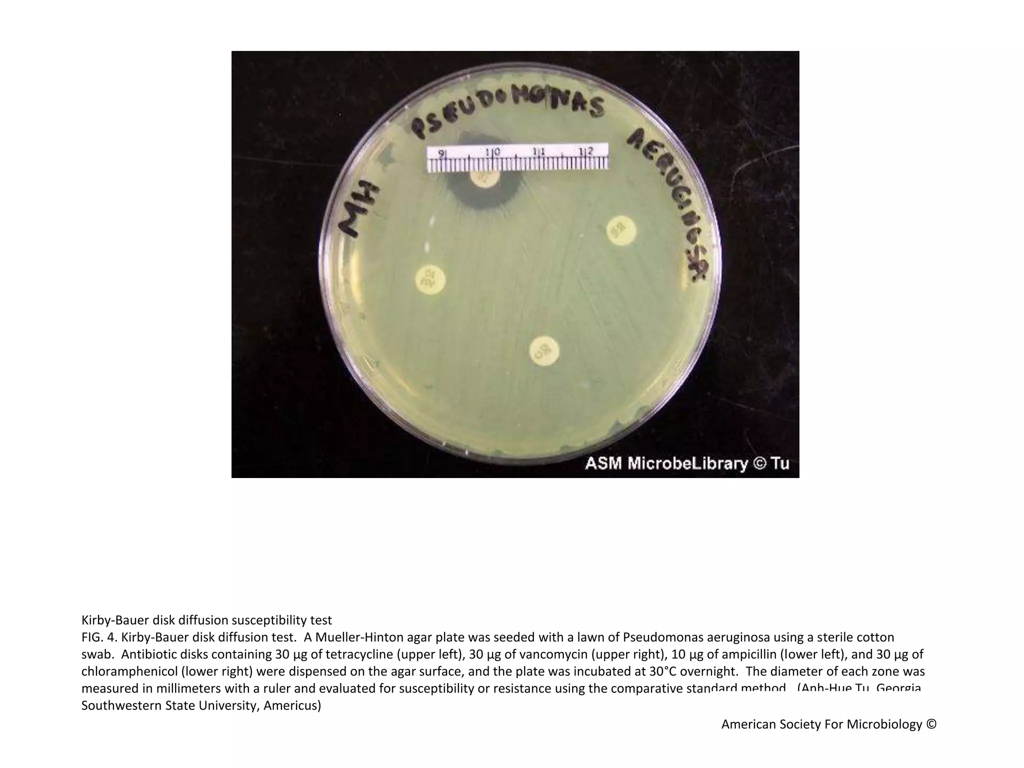 KIRBY-BAUER-DISK-DIFFUSION-SUSCEPTIBILITY-TEST.pptx