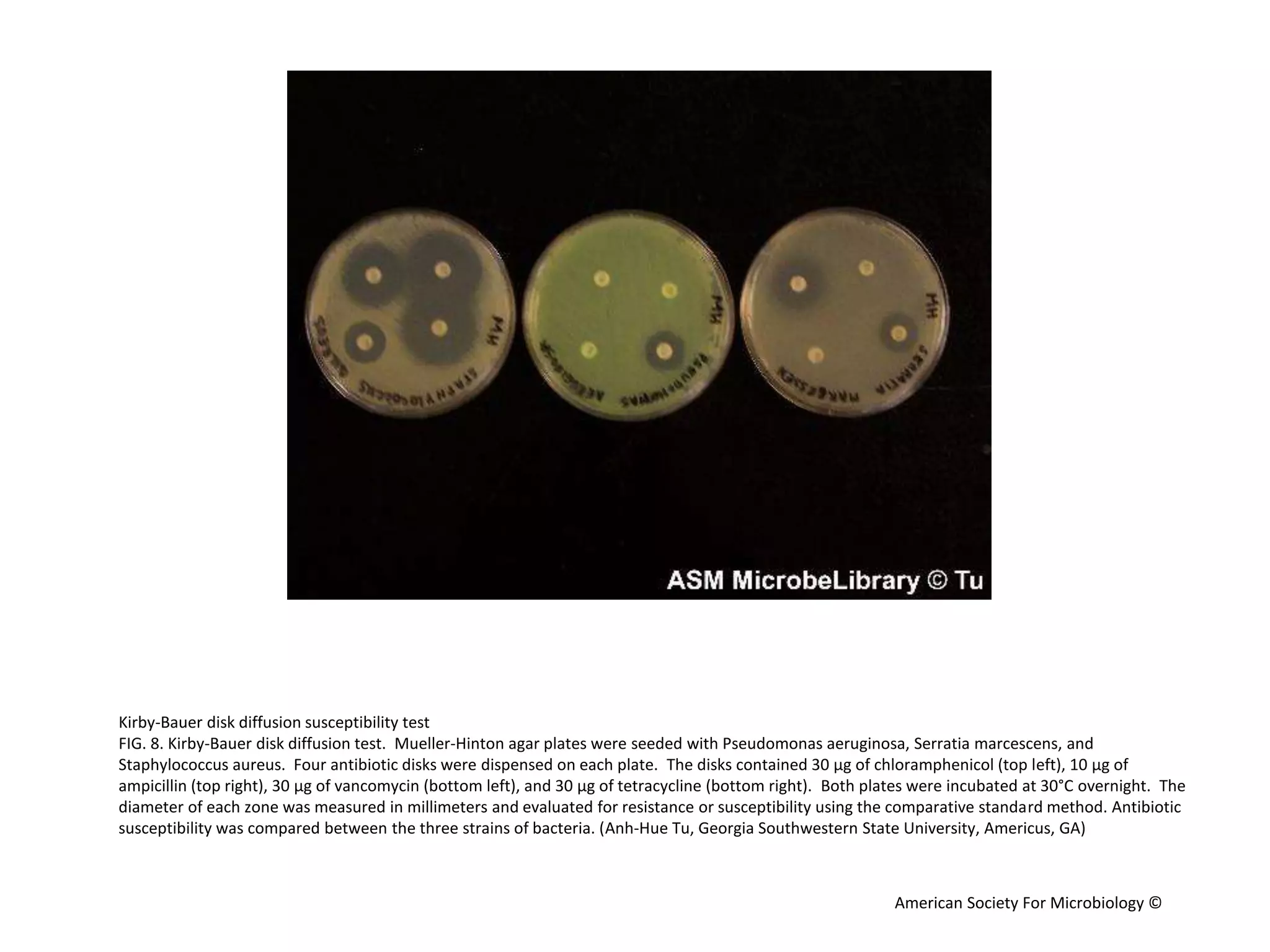 KIRBY-BAUER-DISK-DIFFUSION-SUSCEPTIBILITY-TEST.pptx