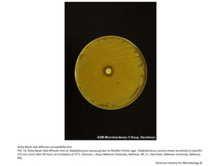 KIRBY-BAUER-DISK-DIFFUSION-SUSCEPTIBILITY-TEST.pptx
