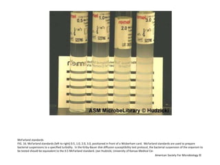 KIRBY-BAUER-DISK-DIFFUSION-SUSCEPTIBILITY-TEST.pptx