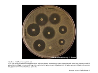 KIRBY-BAUER-DISK-DIFFUSION-SUSCEPTIBILITY-TEST.pptx