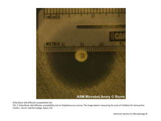 KIRBY-BAUER-DISK-DIFFUSION-SUSCEPTIBILITY-TEST.pptx