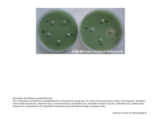 KIRBY-BAUER-DISK-DIFFUSION-SUSCEPTIBILITY-TEST.pptx