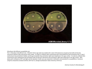 KIRBY-BAUER-DISK-DIFFUSION-SUSCEPTIBILITY-TEST.pptx