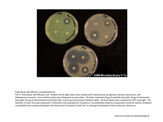 KIRBY-BAUER-DISK-DIFFUSION-SUSCEPTIBILITY-TEST.pptx