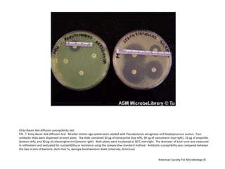 KIRBY-BAUER-DISK-DIFFUSION-SUSCEPTIBILITY-TEST.pptx