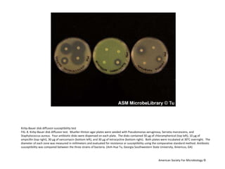 KIRBY-BAUER-DISK-DIFFUSION-SUSCEPTIBILITY-TEST.pptx