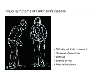 Cell and gene therapy for Parkinson’s disease - part 1 | PDF