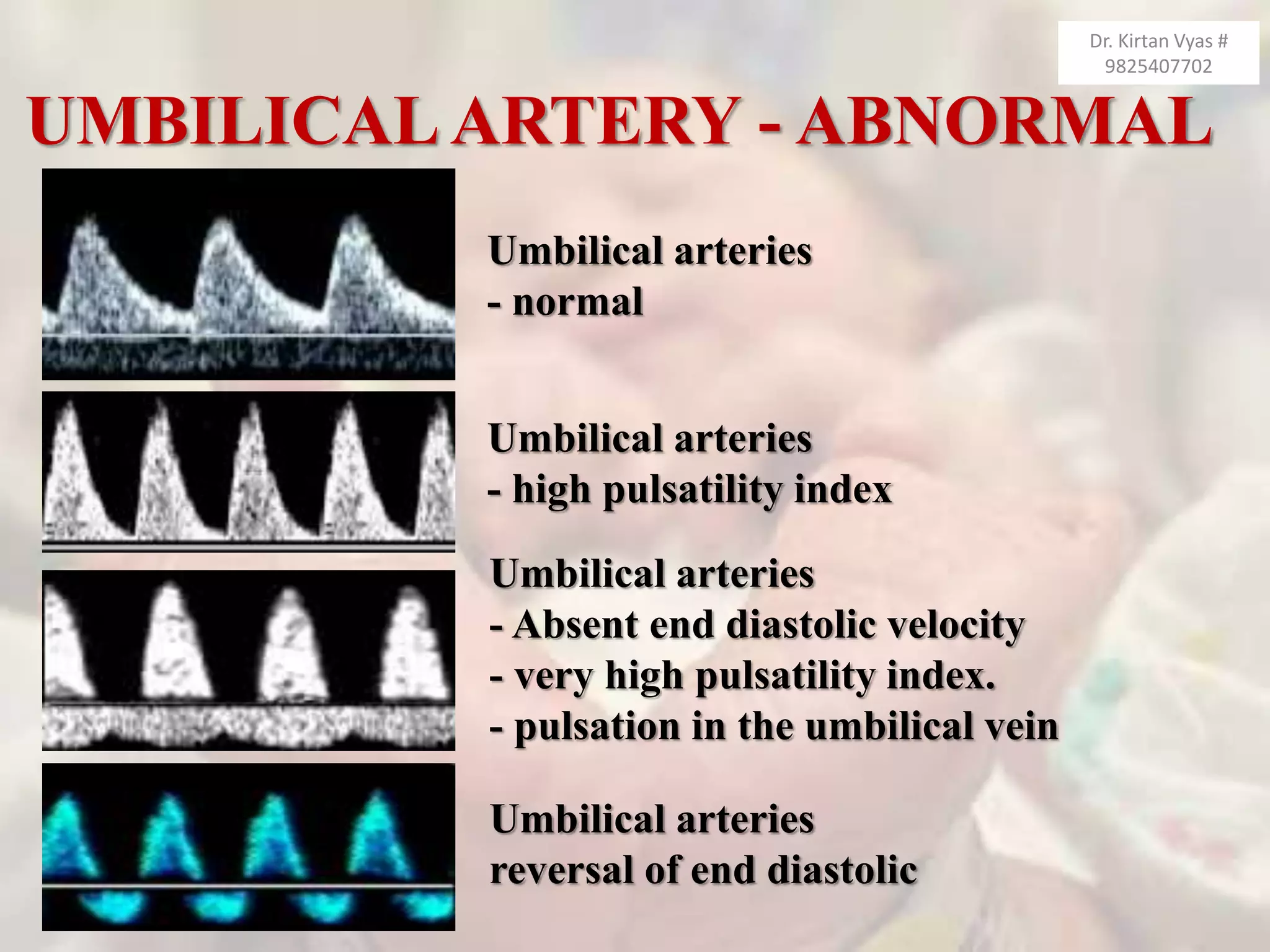 Fetal growth restriction | PPTX