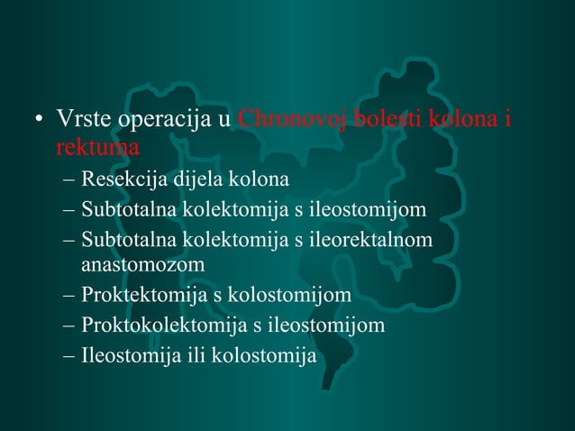 Upalne bolesti crijeva | PPT