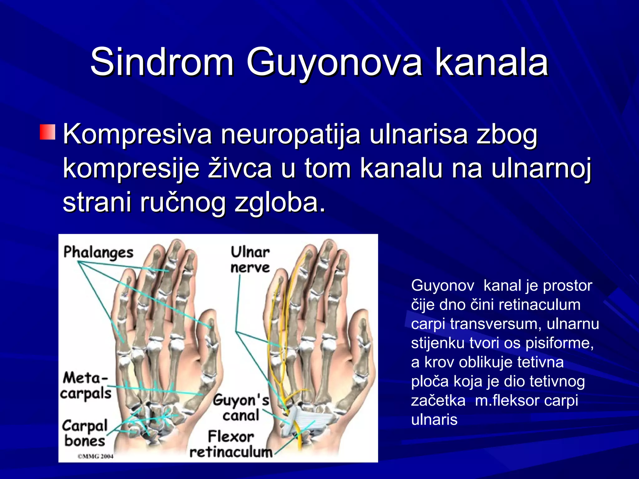 Kirurgija šake | PPT