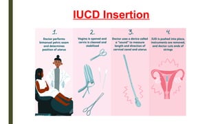 Intrauterine Contraceptive Device - IUCD | PPTX | Birth Control ...
