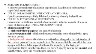 Congenital Cataract | PPTX