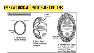 Congenital Cataract | PPT