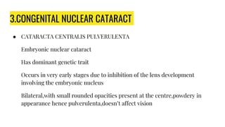 Congenital Cataract | PPTX