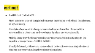 Congenital Cataract | PPTX