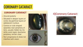 Congenital Cataract | PPT