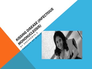 Kissing disease | PPT