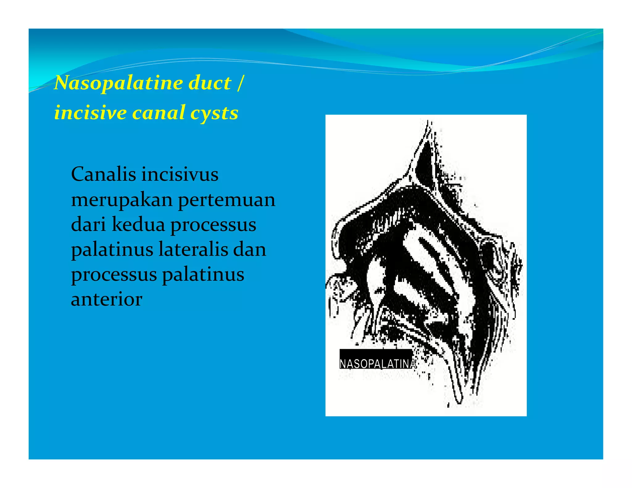 KISTA PADA RONGGA MULUT PPT.pdf