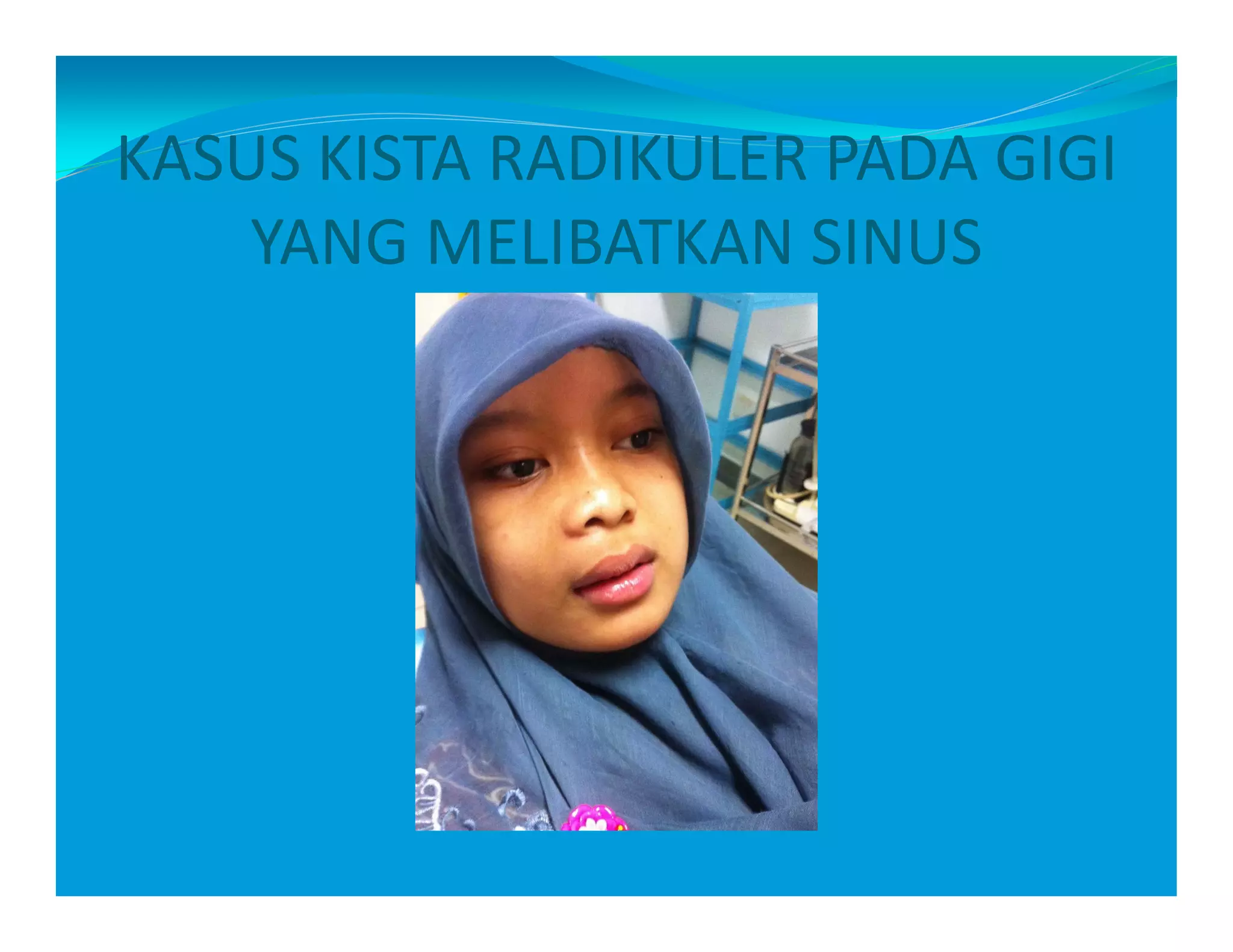 KISTA PADA RONGGA MULUT PPT.pdf