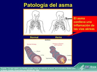 Kit_asma, recomendaciones para pacientes | PPT