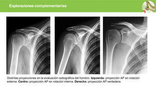 KIT CURSO EXPLORACION_hombro.pptx