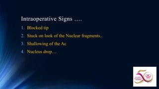 Occult Posterior capsular rent | PPT